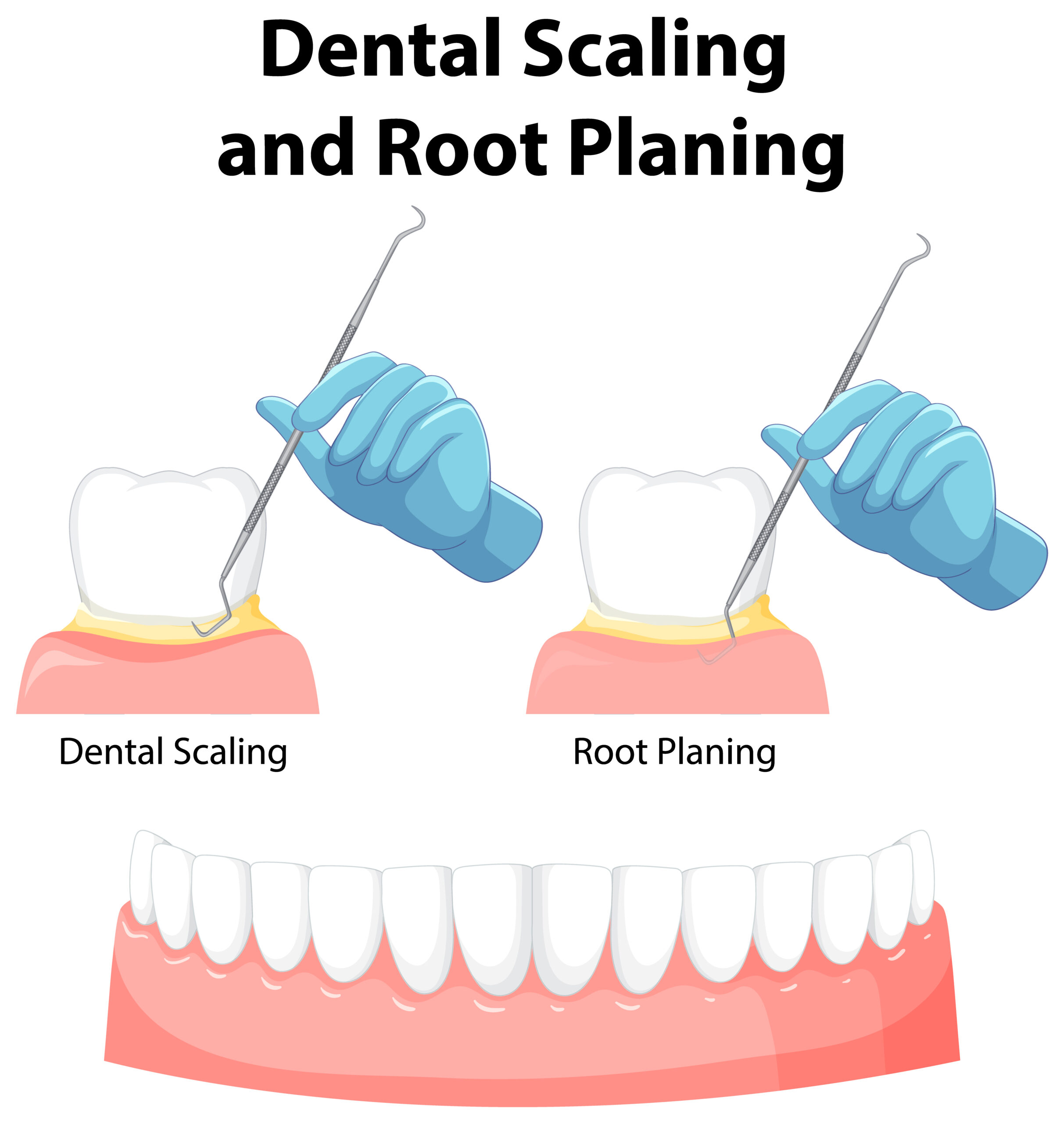 Gums / Periodontal Dentistry